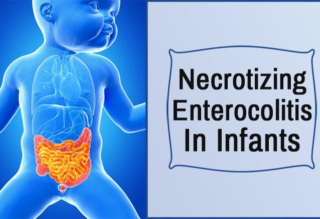 Necrotizing Enterocolitis: Causes, Symptoms And Treatment