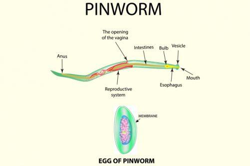 Pinworms In Pregnancy: Causes, Diagnosis And Treatment