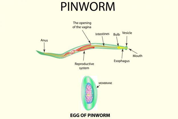Pinworms In Pregnancy: Causes, Diagnosis And Treatment