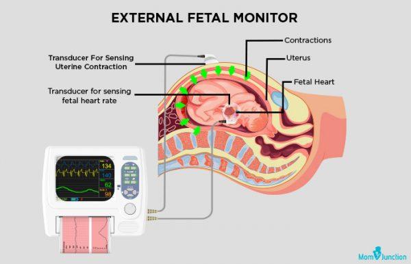 Qué es una prueba de esfuerzo de contracción (CST) y cómo se hace? | Wzrost