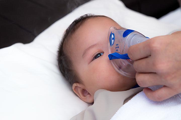 RSV In Babies Causes Symptoms And Treatment RSV In Babies Causes Symptoms And Treatment