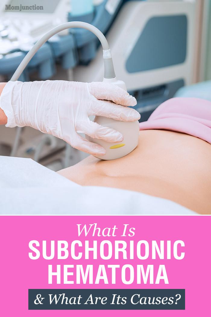 What Is Subchorionic Hematoma And Does It Harm Your Pregnancy?
