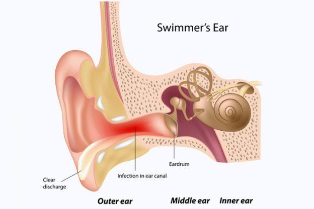 Ear Infection In Children: Causes, Treatment And Home Remedies