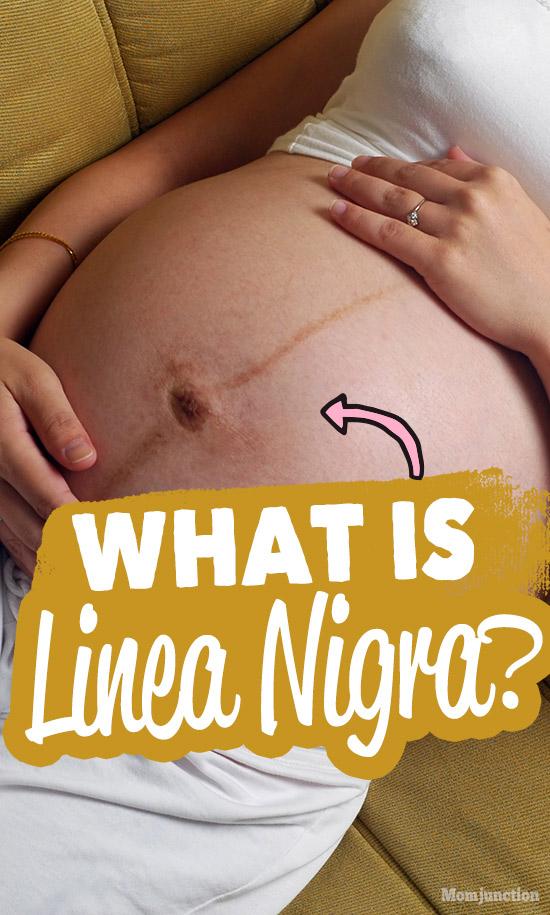 What Is Linea Nigra And Why Does It Occur? - MomJunction