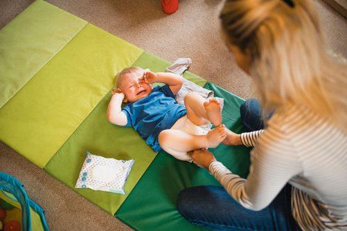Hemorrhoids (Piles) in Babies: Causes, Symptoms and Treatment