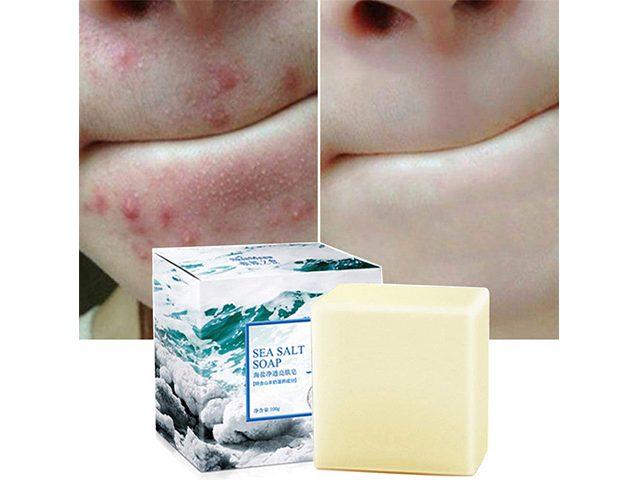 13 Best Soaps For Oily Skin In 2020