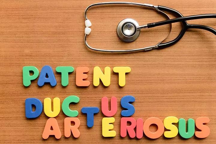 Patent Ductus Arteriosus (PDA): Symptoms And Treatment