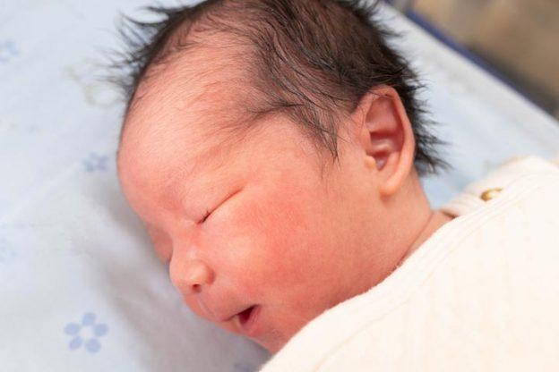 Caput Succedaneum: Definition, Causes, Signs, Images & More