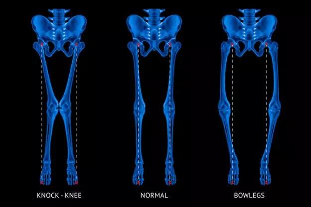 Symptoms, Causes, Risks, And Treatment - ParentsAndMore.com