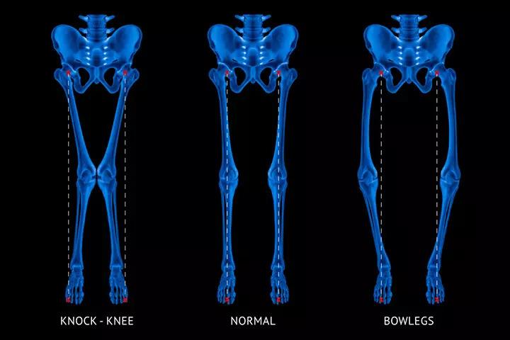 Symptoms, Causes, Risks, And Treatment - ParentsAndMore.com