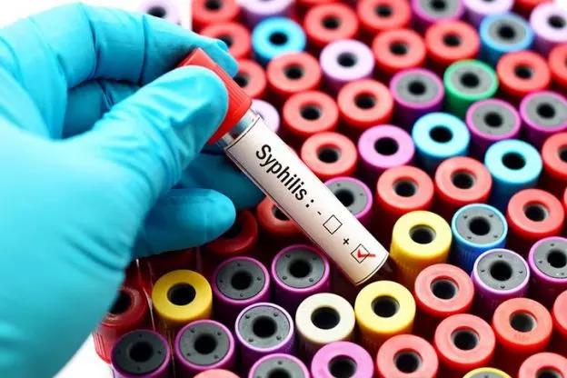 Syphilis In Babies: Symptoms, Diagnosis And Treatment - ParentsAndMore.com