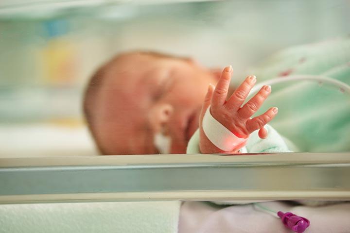 Polydactyly (Extra Fingers On Babies): Causes And Treatment