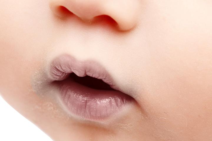 Circumoral Cyanosis In Newborn: Causes, Symptoms & Treatment ...