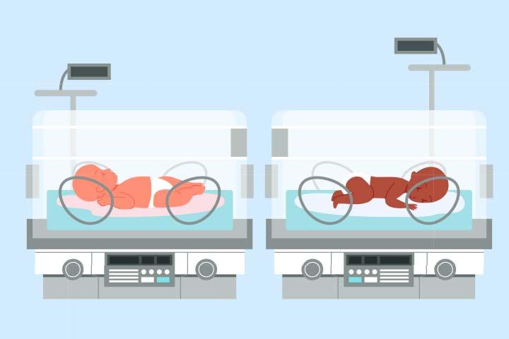Sacral Dimples in Newborn: Symptoms, Causes And Treatment