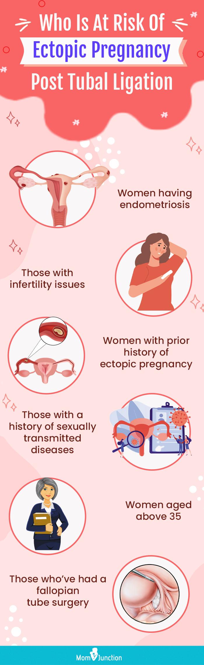 Tubal Ligation