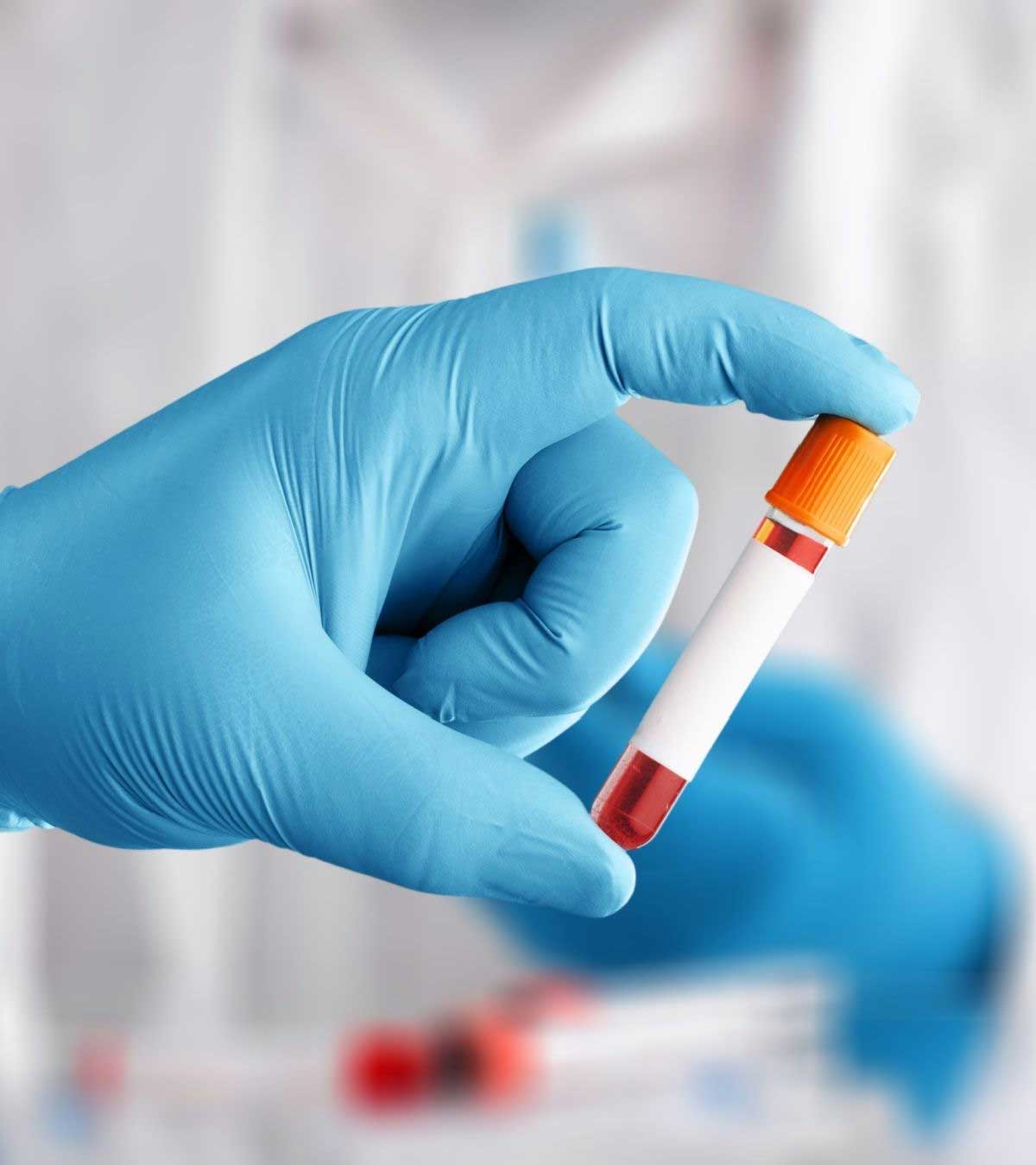 Child Blood Type Calculator | Predict Your Baby Blood Group